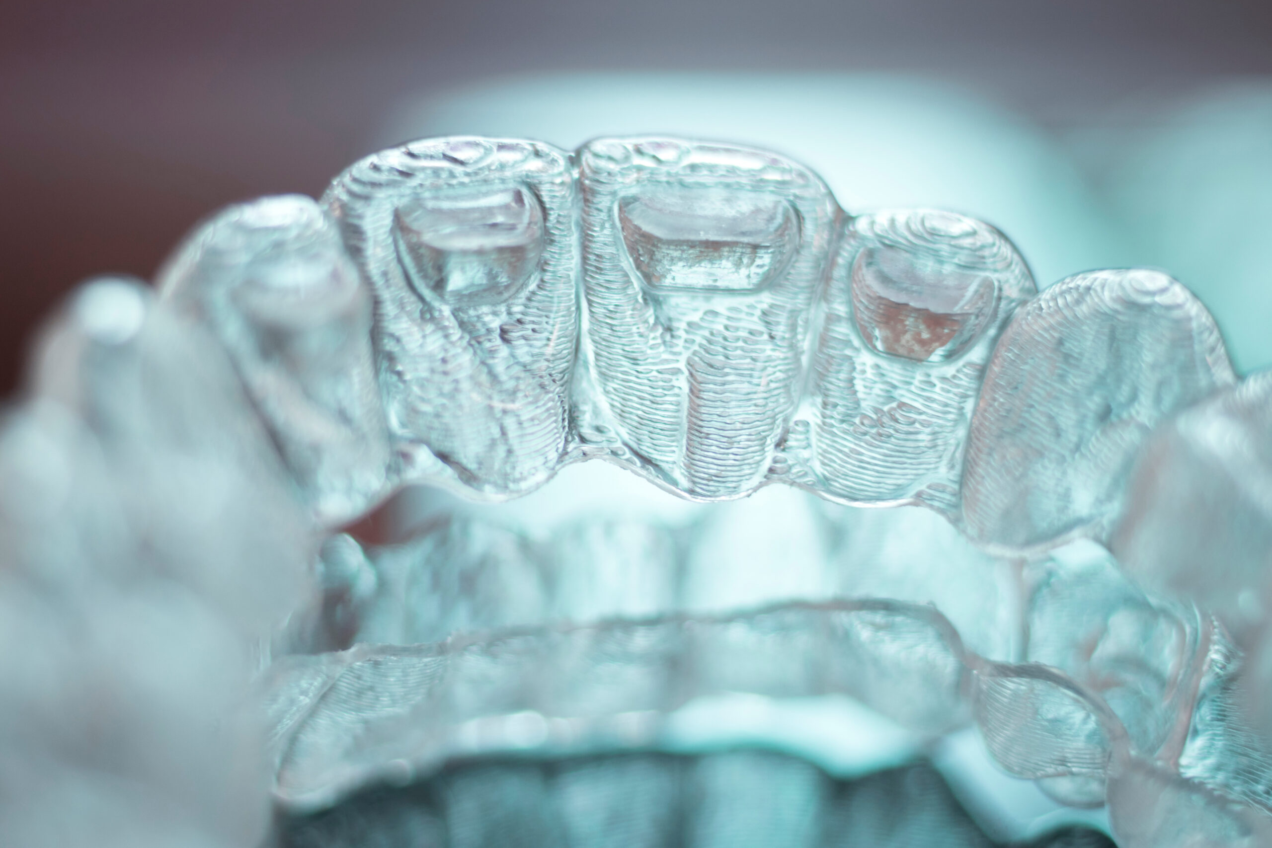 Invisalign in Wyoming - Craft Dentistry